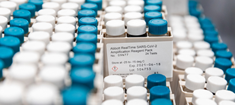 COVID-19: os diferentes testes de diagnósticos | Abbott Newsroom